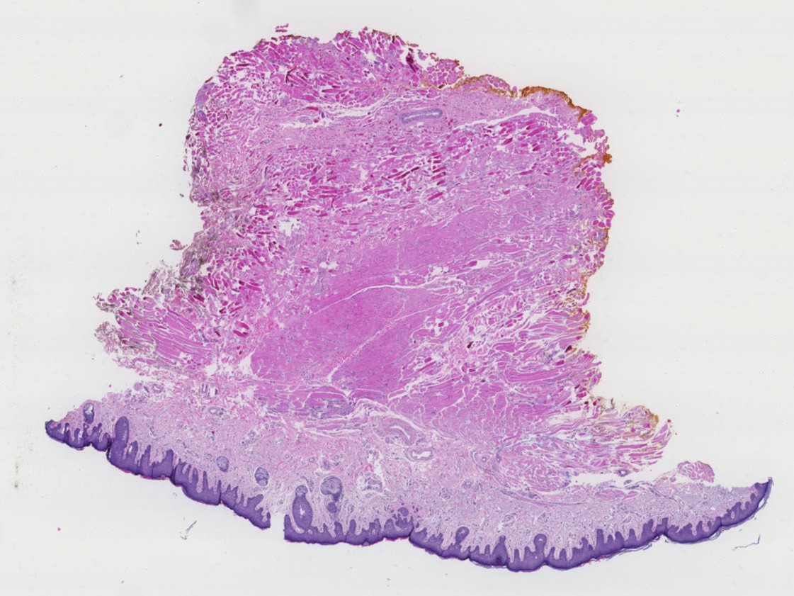 Skin data from the Visual Sweden project DROID | doi:10.23698/aida/drsk ...