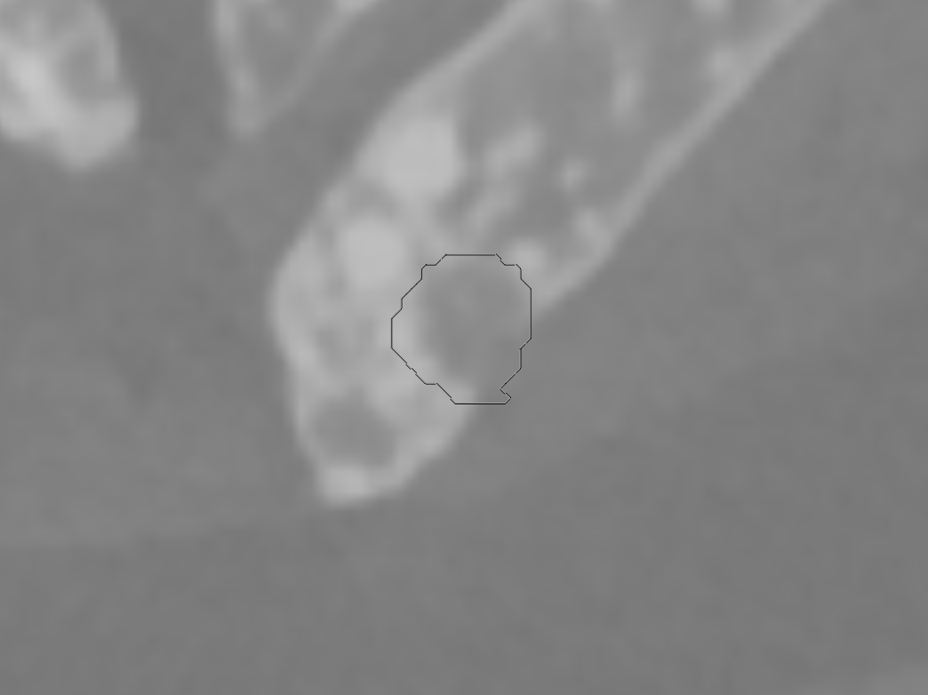 Anonymization examples | AIDA Data Hub