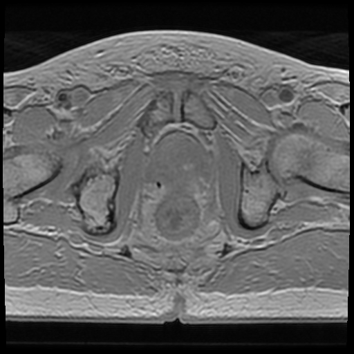 Multi-echo gradient echo (MEGRE) | doi:10.23698/aida/megre | AIDA ...