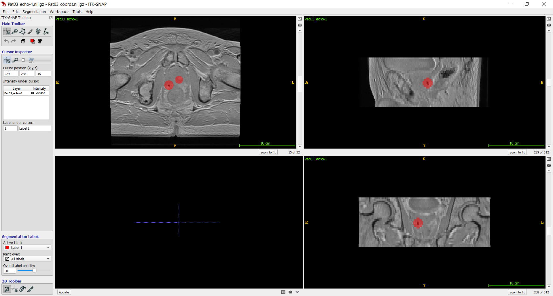 Multi-echo gradient echo (MEGRE) | doi:10.23698/aida/megre | AIDA ...