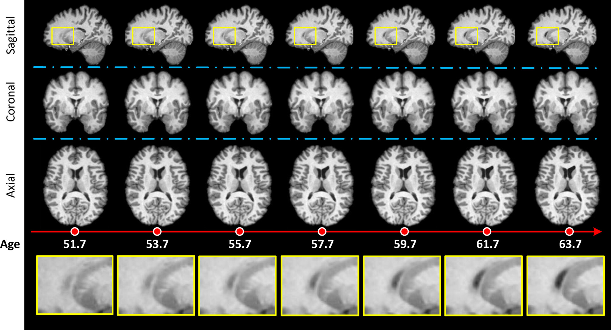 Synthetic healthy brain aging MRIs with segmentation masks | doi:10.23698/aida/synthetic/shbamri ...